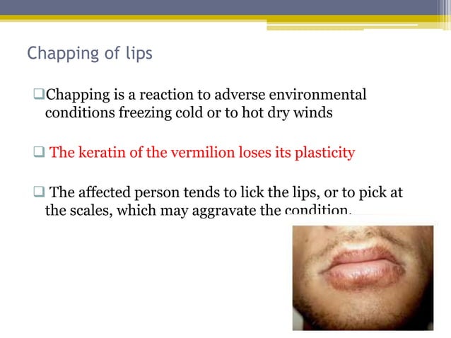 Disorders of lip | PPTX