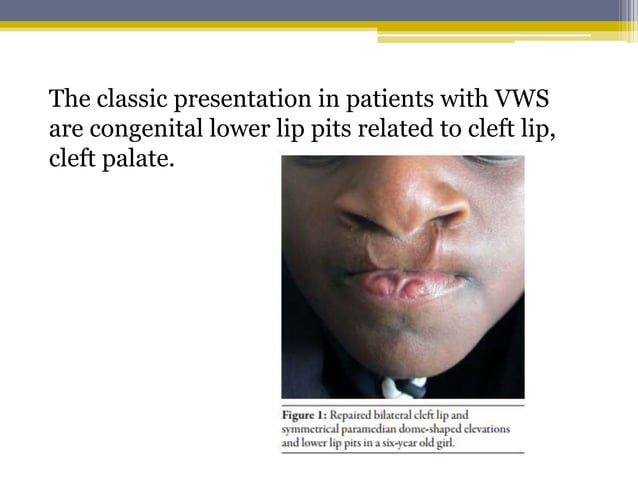 Disorders of lip | PPTX