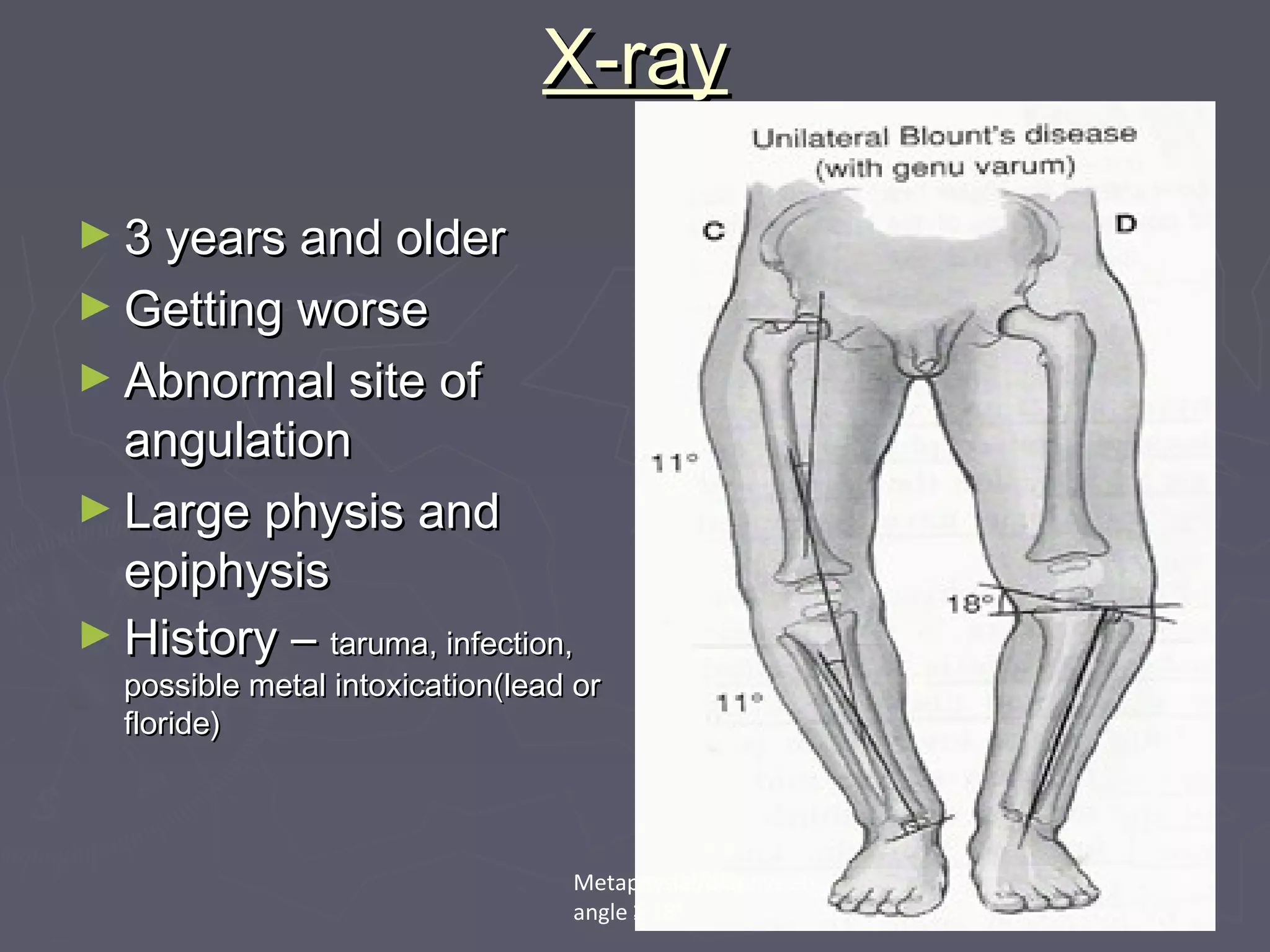 Disorders of Lower Limb | PPT