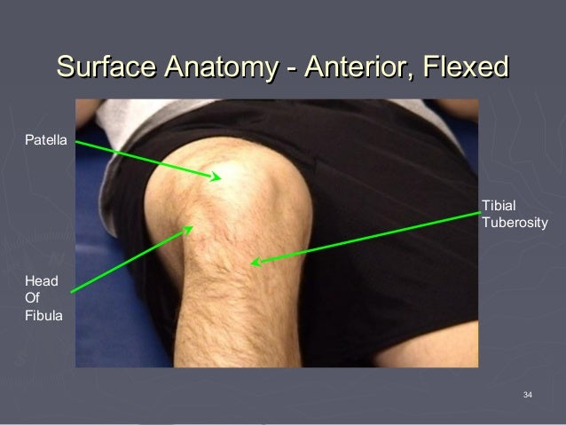 Disorders of Lower Limb