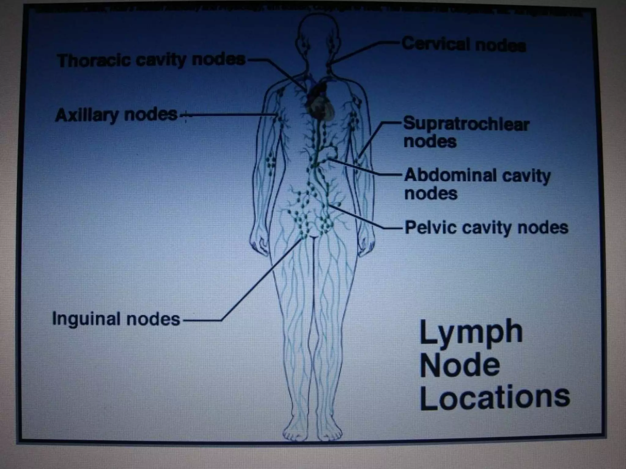 Disorders of lymphatics | PPTX