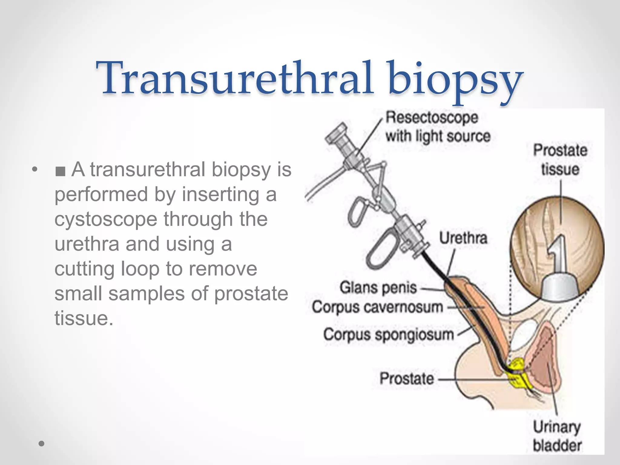 Disorders of male reproductive system | PPTX
