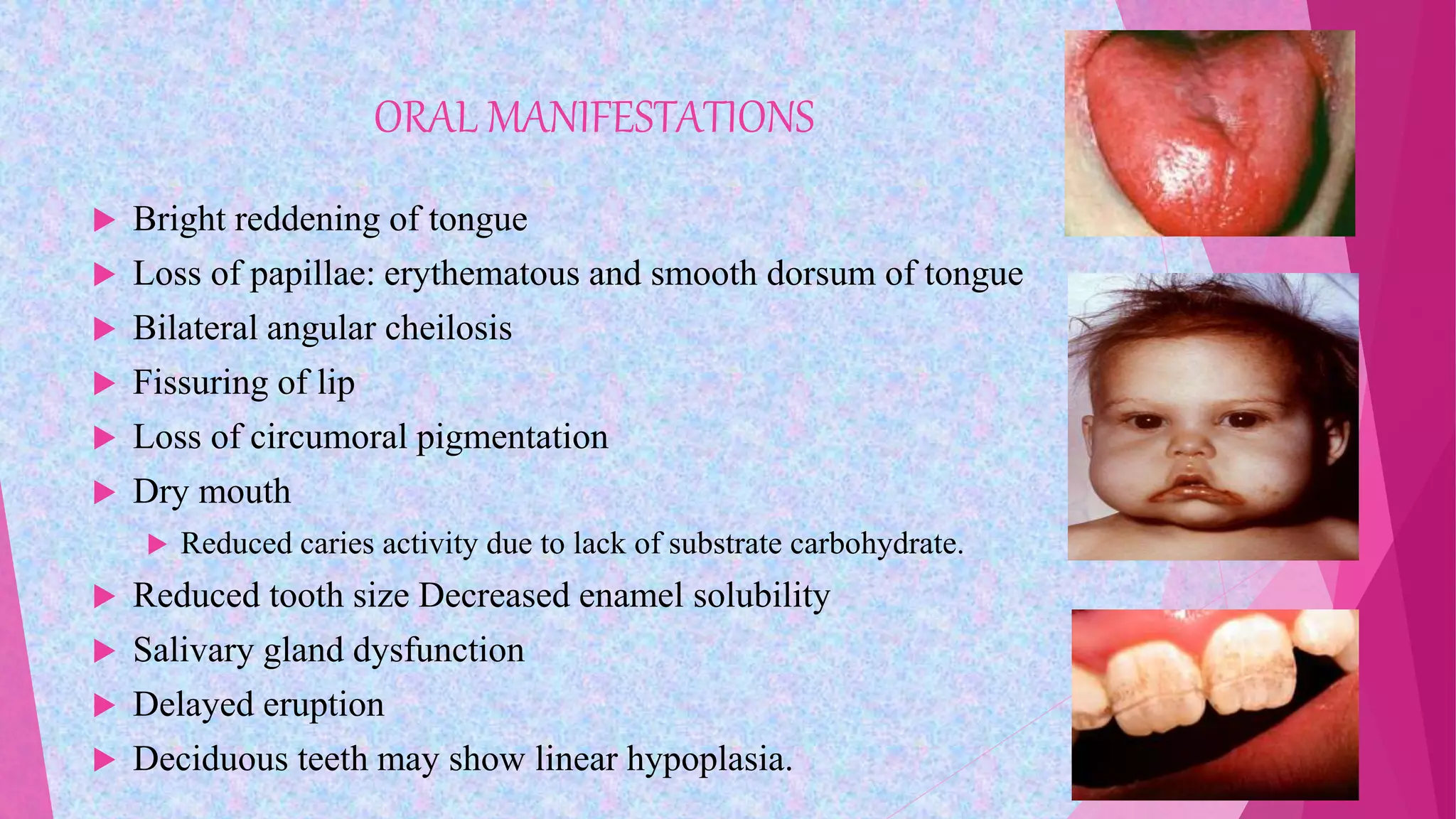 Disorders of malnutrition | PPTX