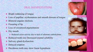 Disorders of malnutrition | PPTX