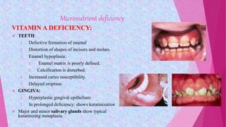 Disorders of malnutrition | PPTX