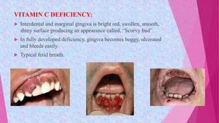 Disorders of malnutrition | PPTX