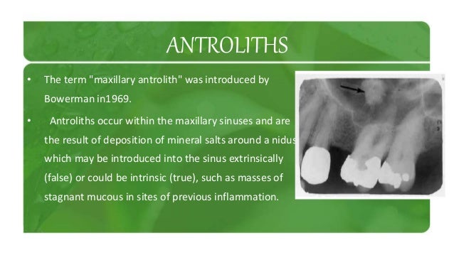 Disorders of maxillary sinus