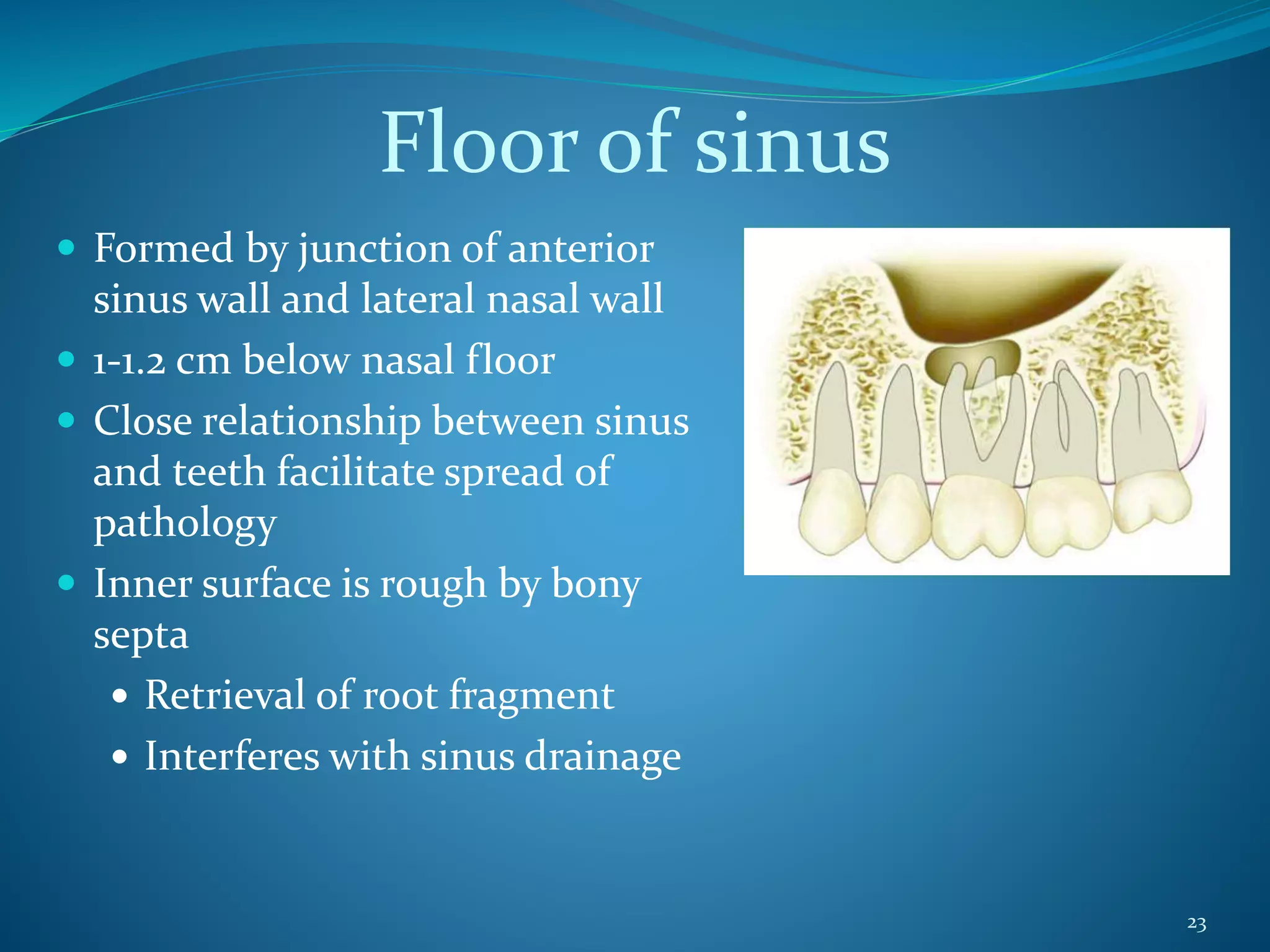 Disorders Of Maxillary Sinus Ppt