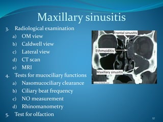 Disorders of Maxillary Sinus | PPTX