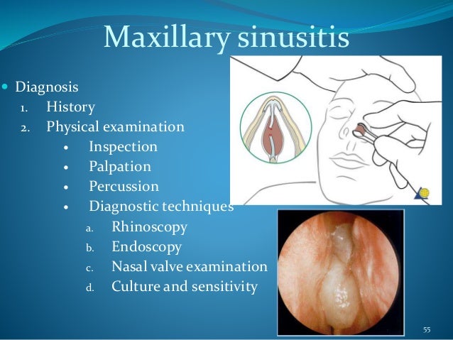 Disorders of Maxillary Sinus