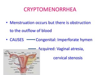 Disorders of menstruation | PPTX
