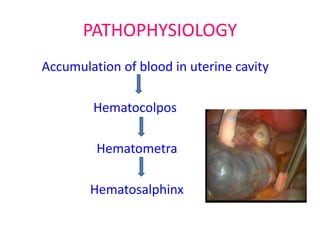 Disorders of menstruation | PPTX