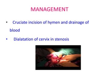 Disorders of menstruation | PPTX
