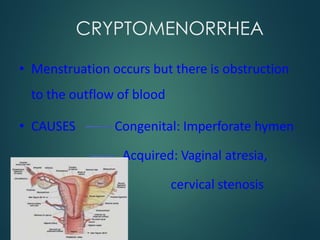 Disorders of menstruation.pdf