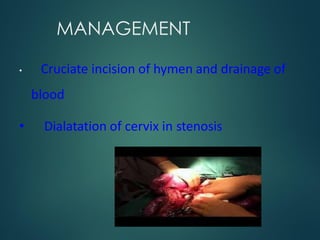 Disorders of menstruation.pdf
