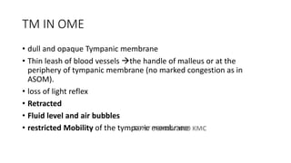 Disorders of middle ear revision notes | PDF