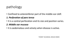 Disorders of middle ear revision notes | PDF