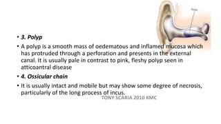 Disorders of middle ear revision notes | PDF