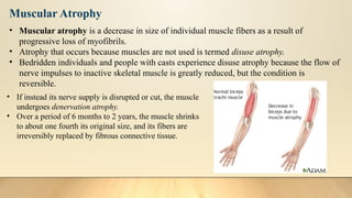 DISORDERS OF MUSCLE - Myasthenia gravis .pptx