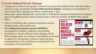 DISORDERS OF MUSCLE - Myasthenia gravis .pptx