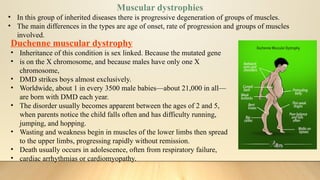 DISORDERS OF MUSCLE - Myasthenia gravis .pptx