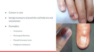 Disorders of nails | PDF