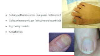 Disorders of nails | PDF