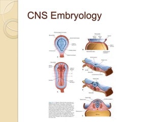 Disorders of neural tube closure and neuronal migration | PPTX