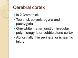 Disorders of neural tube closure and neuronal migration | PPTX
