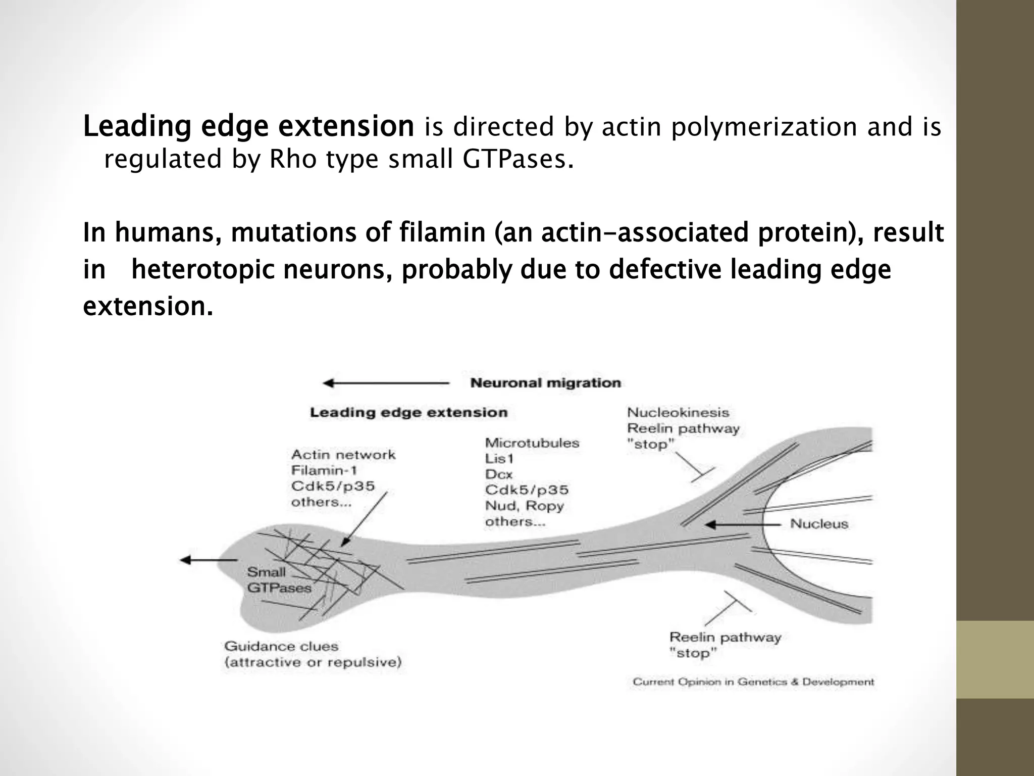Disorders of neuronal migration | PPTX