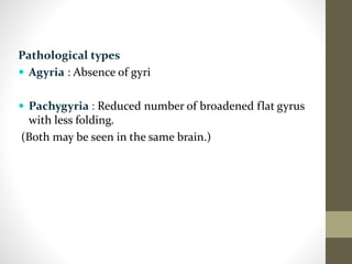 Disorders of neuronal migration | PPTX