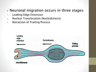 Disorders of neuronal migration | PPTX
