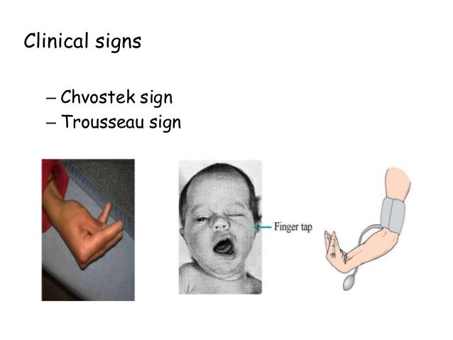 Disorders of parathyroid gland