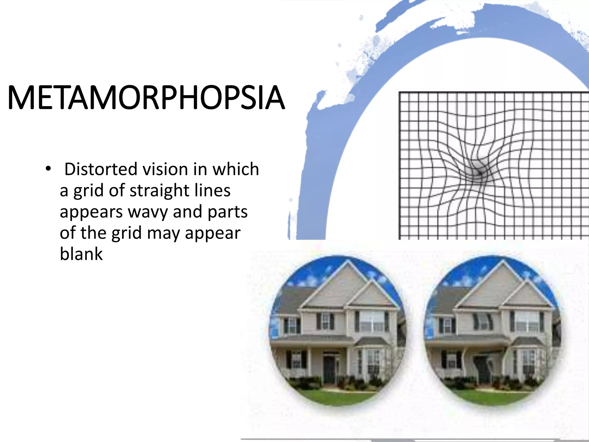 Disorders of perception | PPTX