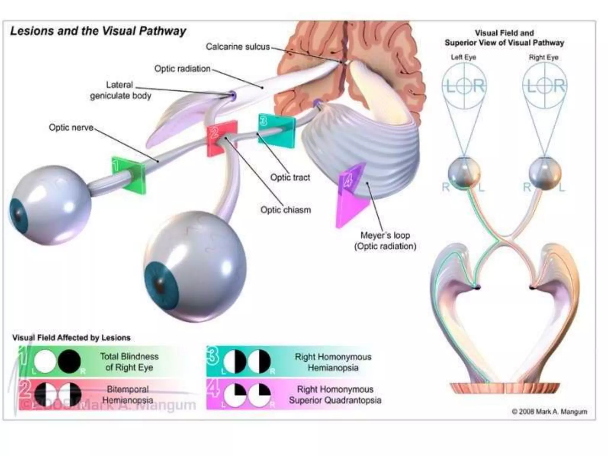 Disorders of perception | PPTX