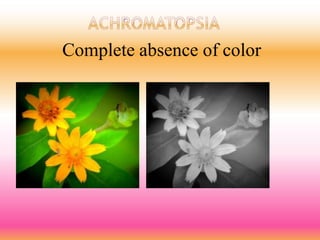 Disorders of Perception.pptx