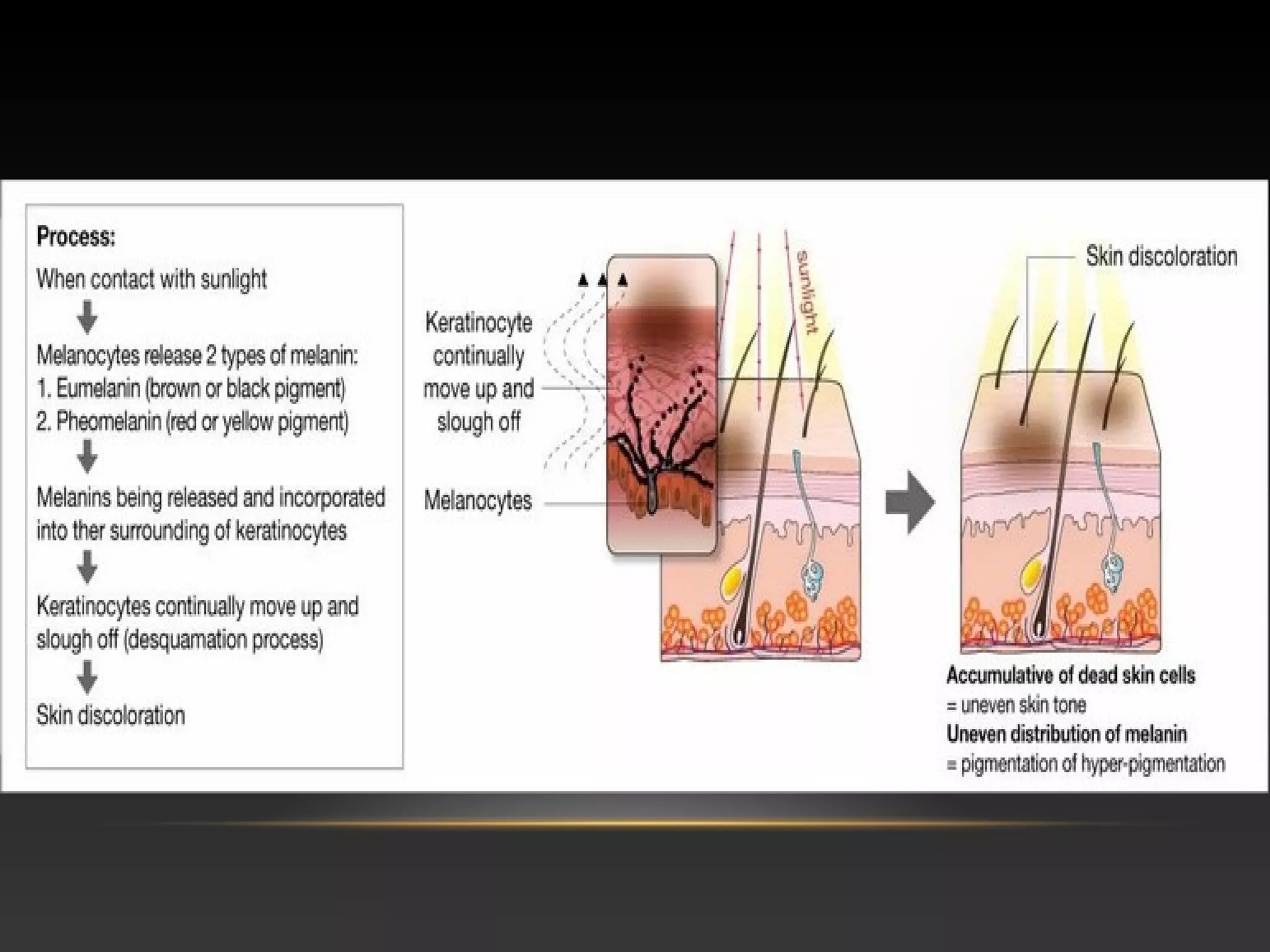 Disorders of pigmentation | PPT