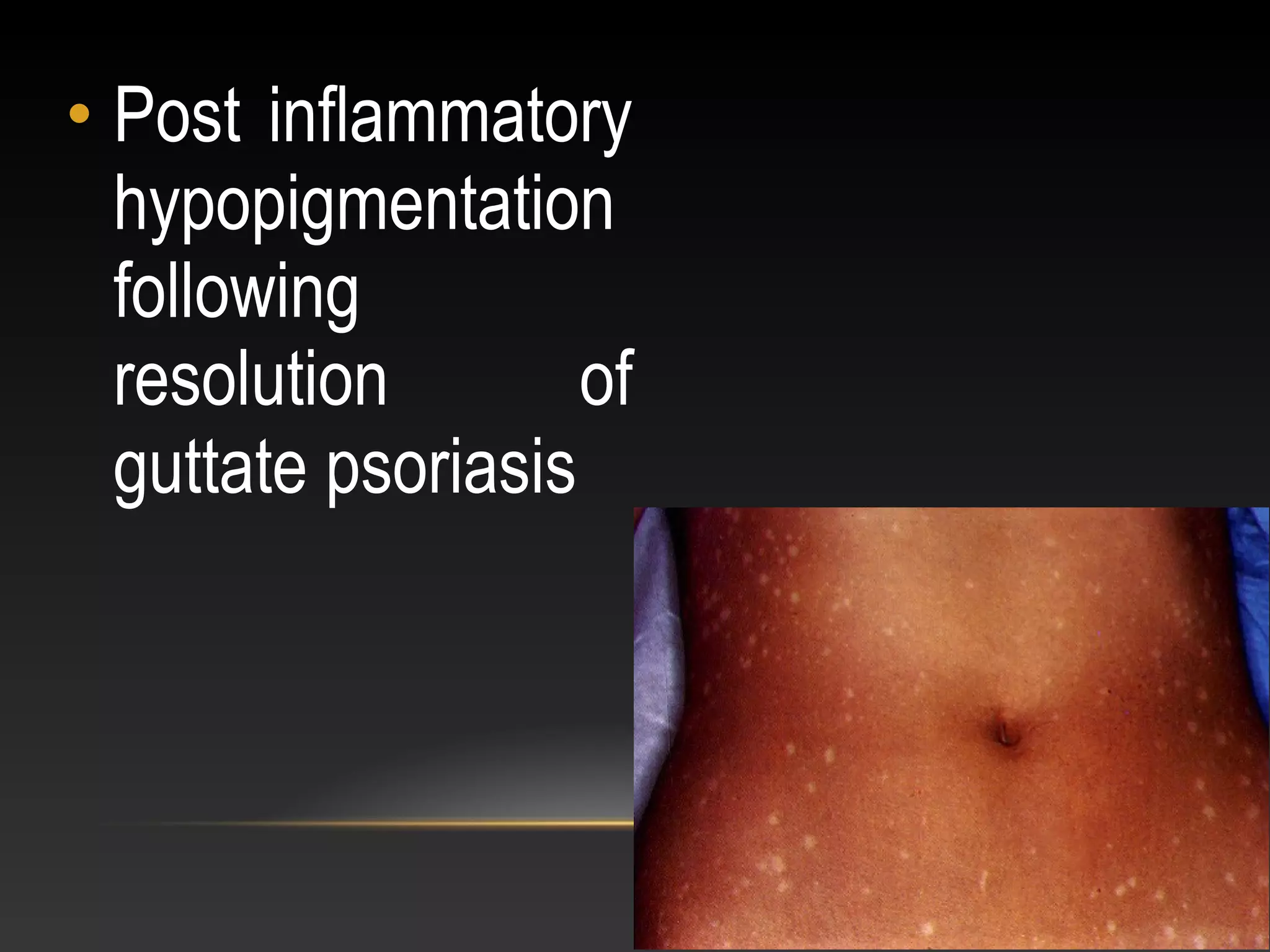 Disorders of pigmentation | PPT