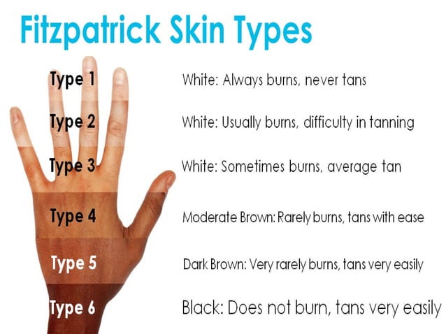 Disorders of pigmentation | PPT | Skin and Dermatology | Diseases and ...