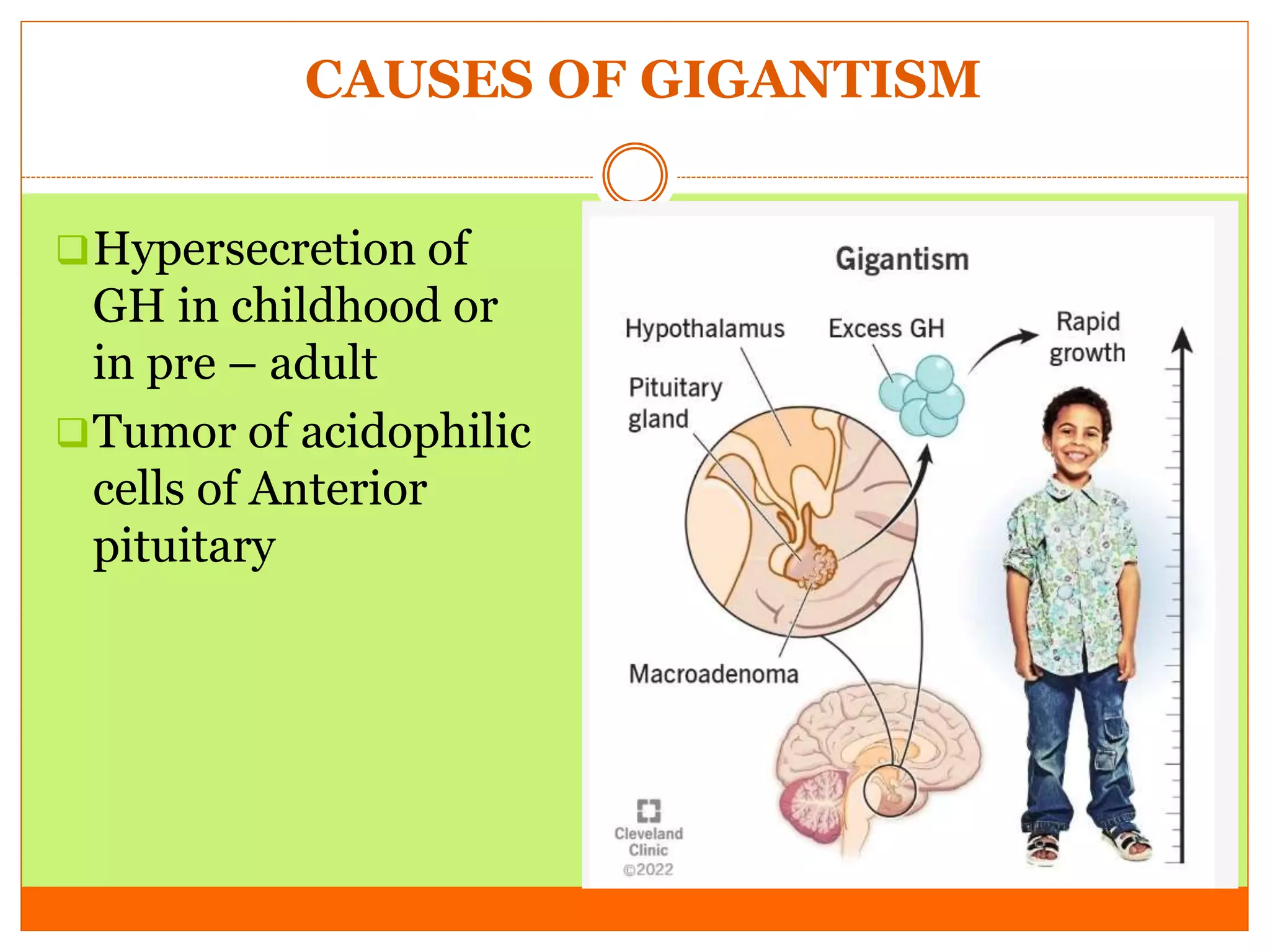 DISORDERS OF PITUITARY G.pptx | Hormonal Disorders | Endocrine and ...
