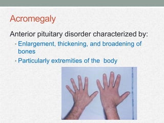 disordersofpituitarygland-110503063404-phpapp01 (1)-converted.pptx.ppt