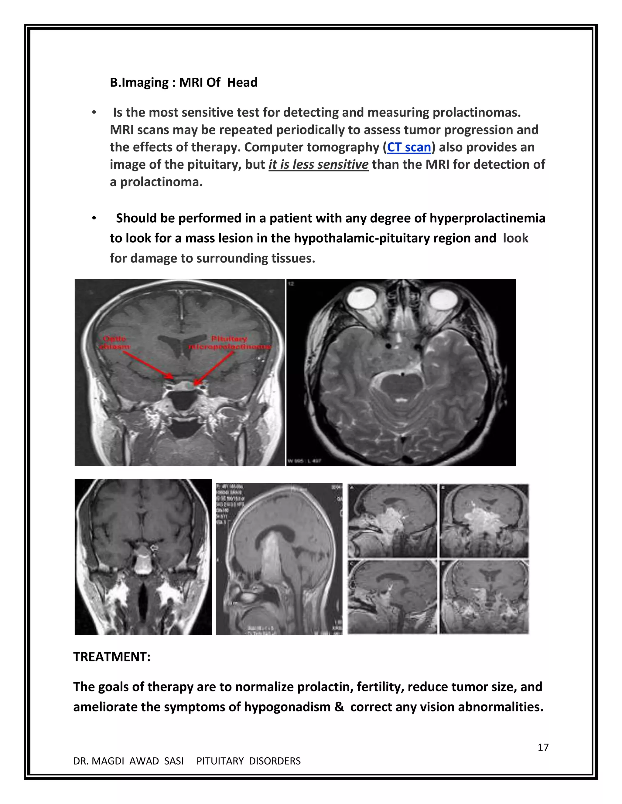 Disorders of pituitary gland (( THE MASTER )) BY M.SASI