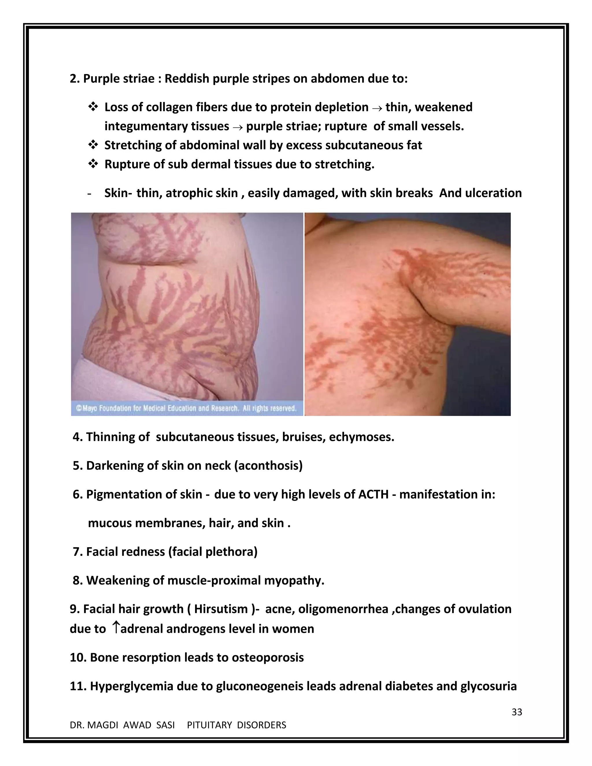 Disorders of pituitary gland (( THE MASTER )) BY M.SASI