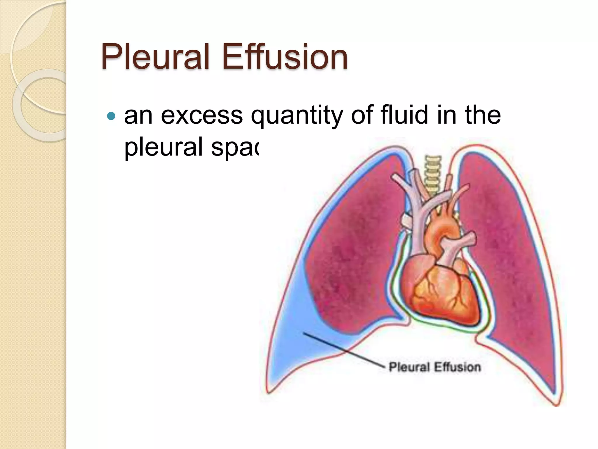 Disorders of pleura | PPTX