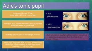 Trastornos de la pupila - Disorders of pupil | PPTX