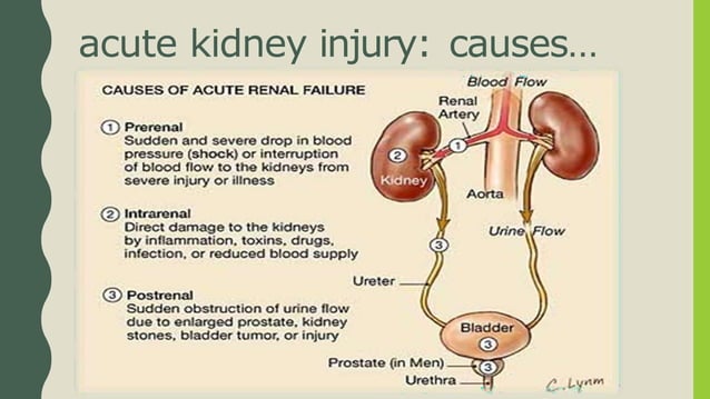 Disorders of Renal Function | PPTX | Endocrine and Metabolic Diseases ...