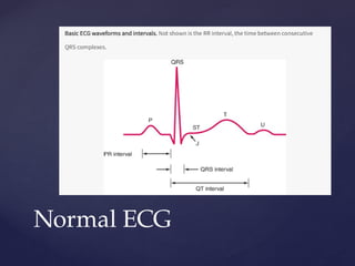 Disorders of Rhythm (Cardiology cycle Lectures 2024).pptx
