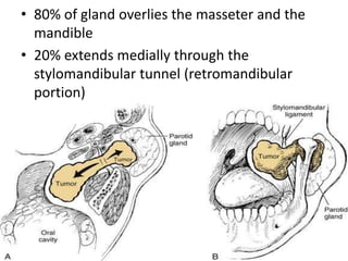 DISORDERS OF SALIVARY GLANDS-1- tumors,stones | PPTX