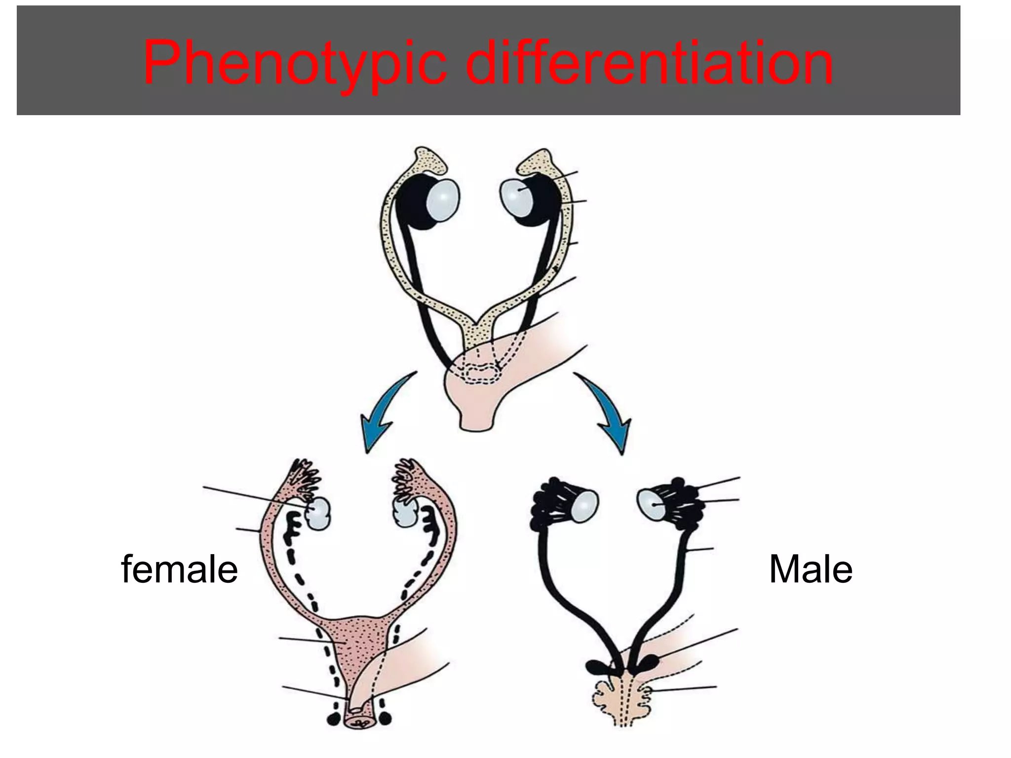 Disorders Of Sex Development Pptx