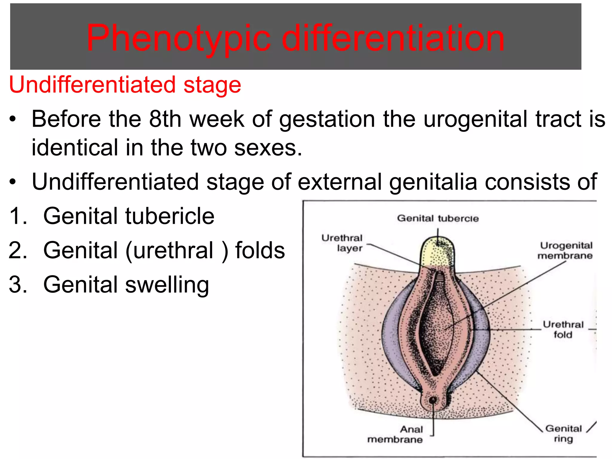Disorders Of Sex Development Pptx